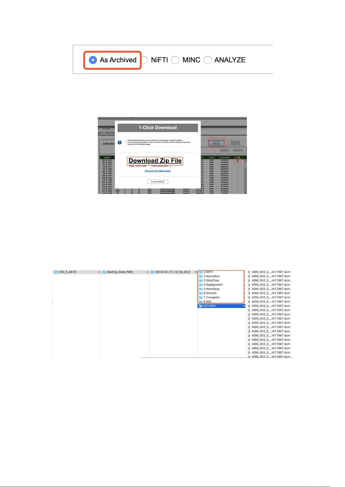 ADNI_rs-fMRI数据预处理过程_matlab.docx_基于matlab的图像处理资源-CSDN下载