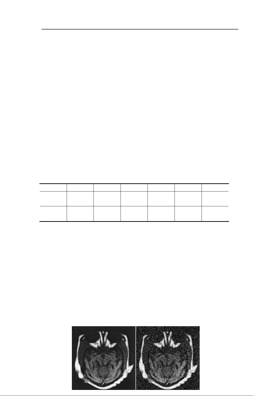 【老生谈算法】医学图像小波去噪的matlab实现doc资源 Csdn下载